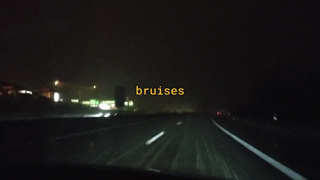 Bruises by Vaboh on TIDAL